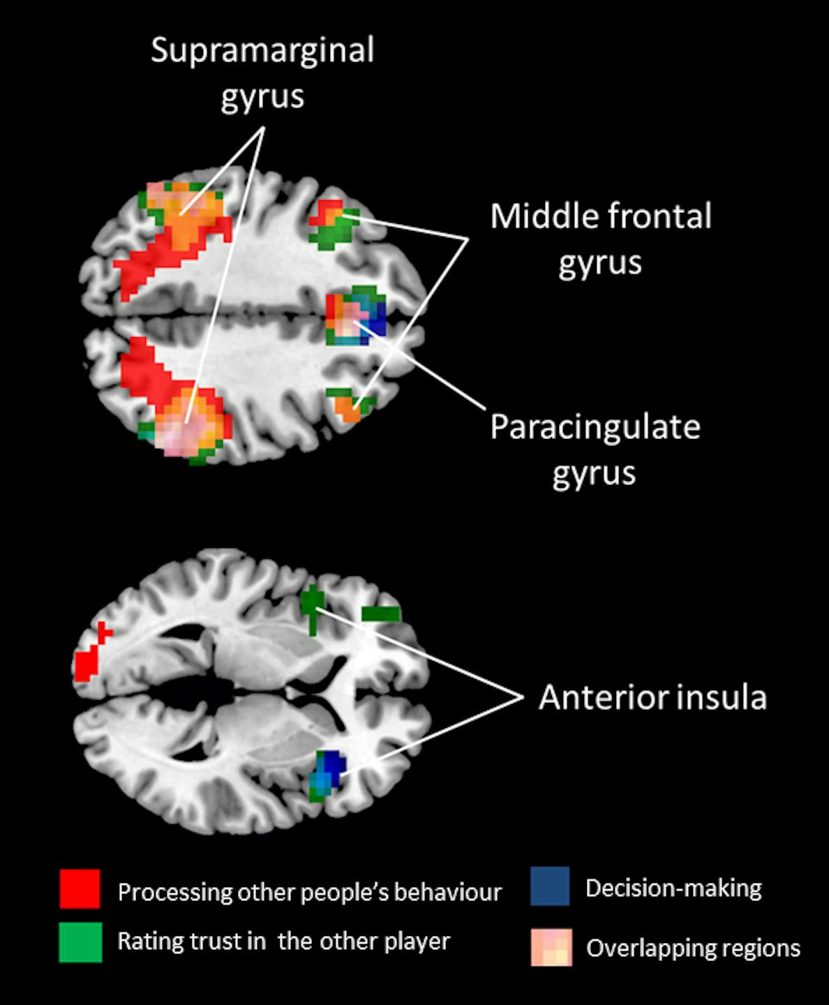 MDMA Science: New Study Explains How It Affects Social Relationships ...