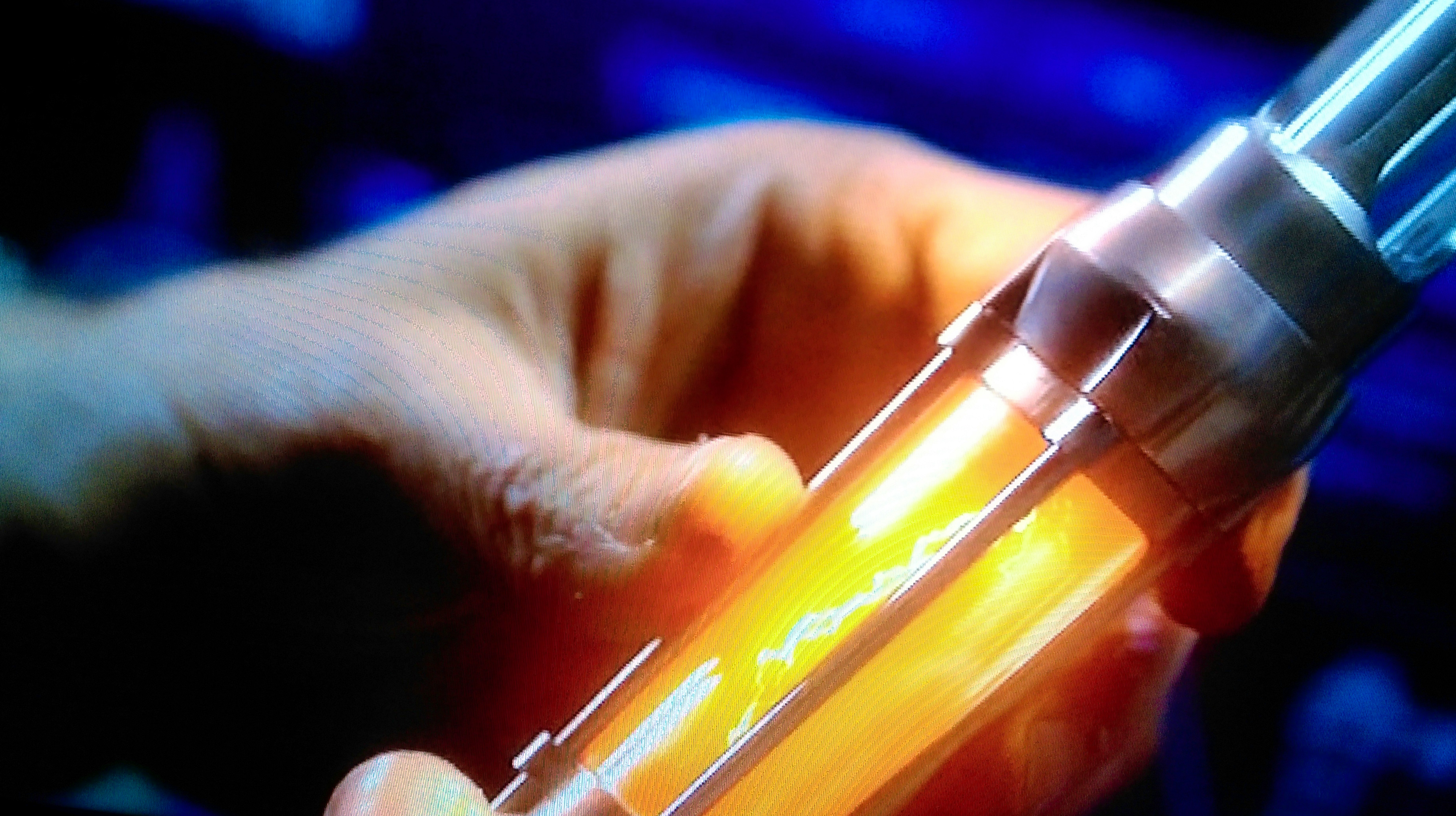 'The Flash:' “Fast Lane” (S2 E12) | Inverse