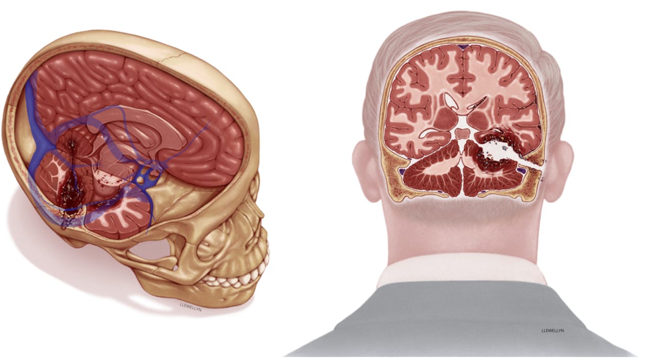 Robert F Kennedy New Assassination Details Revealed In Medical