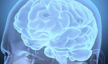 Scientists Gaze Into Sleeping People's Brains to See What They're ...
