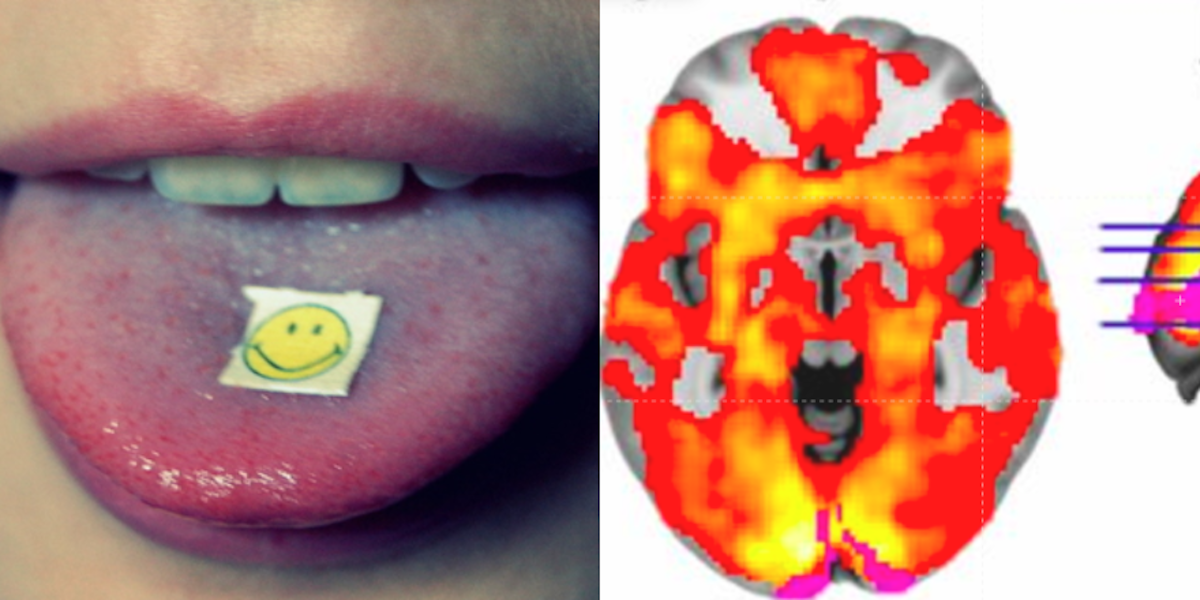 What Your Brain Actually Looks Like On Different Drugs Inverse