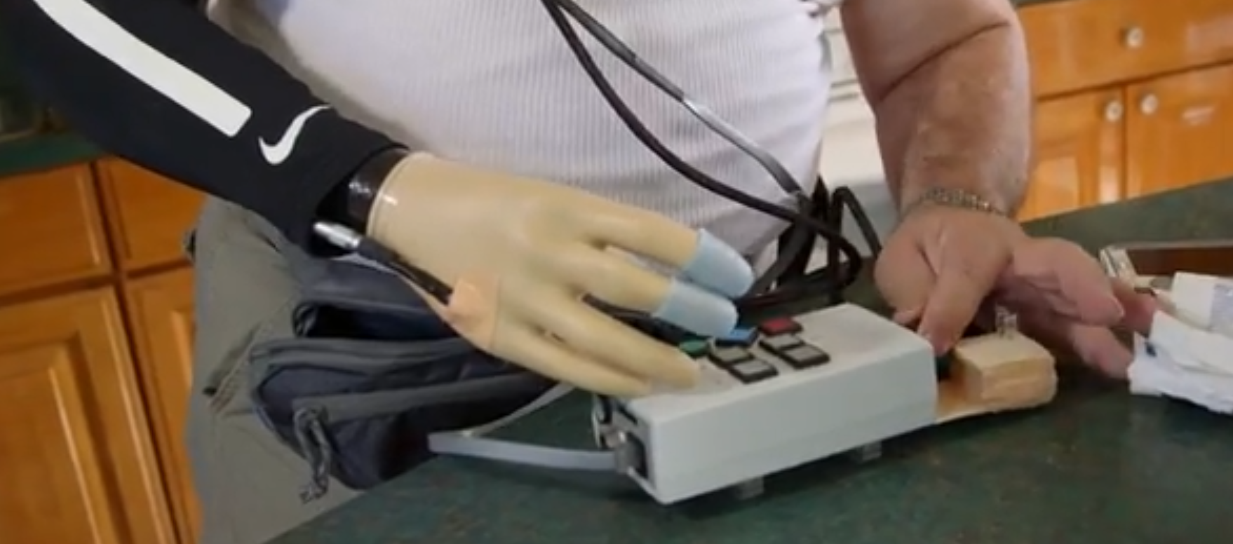 Neuroscientists Restore the Sense of Touch to Amputees with Prosthetic ...