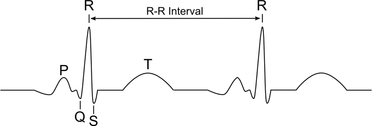 Scientist Finds a Hidden Diagnosis in Fitness Watch Heart Rate Data ...