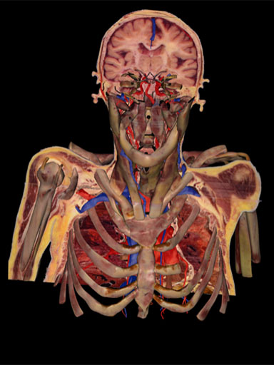 This Woman Became a "Living Cadaver" in the Name of Progressive Science ...