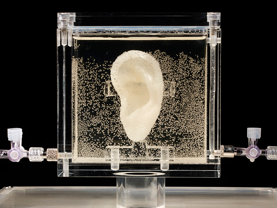 Does This Genetic Replica of Van Gogh's Ear Still Belong to the Artist ...