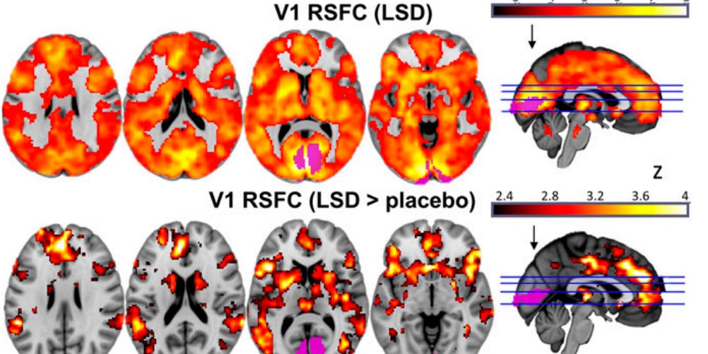 New Brain Images Show How LSD Affects Our Minds | Inverse
